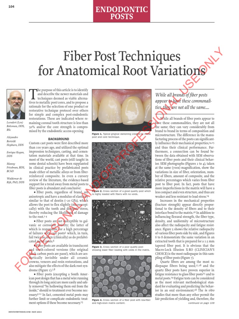 Fiber Post | PDF | Dental Composite | Mouth