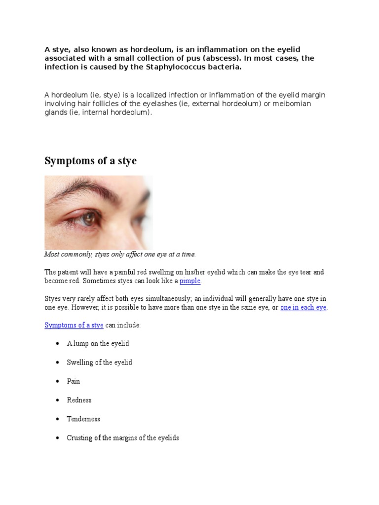 A Stye | PDF | Clinical Medicine | Diseases And Disorders