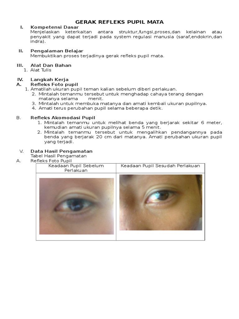 Refleks Pupil pada Cahaya Terang | PDF
