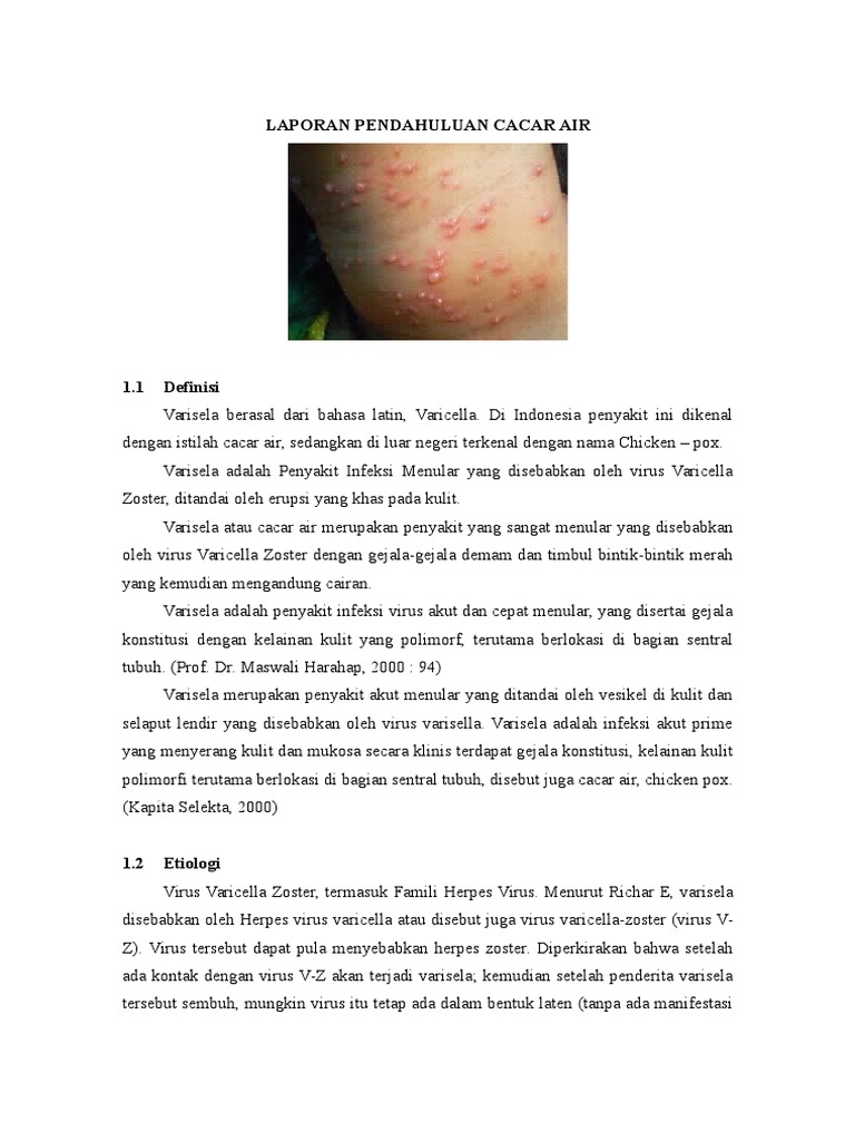 Laporan Pendahuluan Cacar Air | PDF