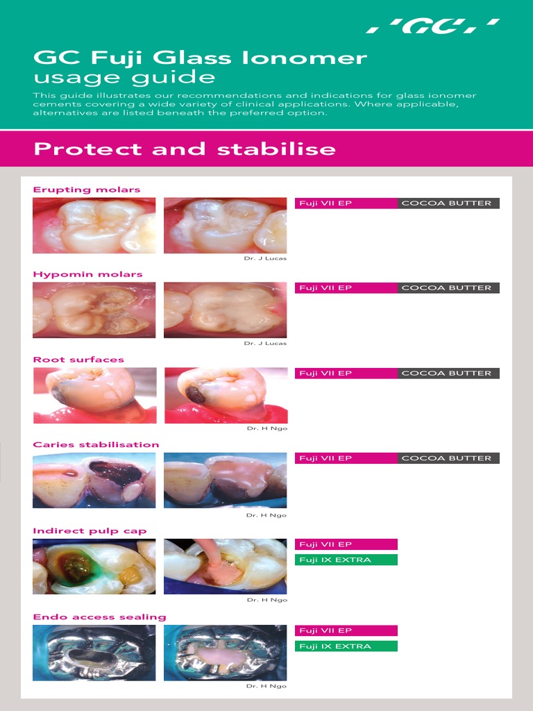 GIC Fuji | PDF | Dentistry | Mouth