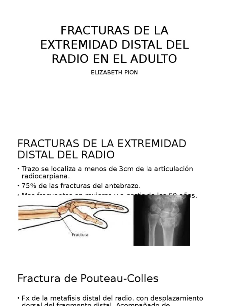 Clasificación de fracturas del radio distal | PDF | Lesión | Sistema ...