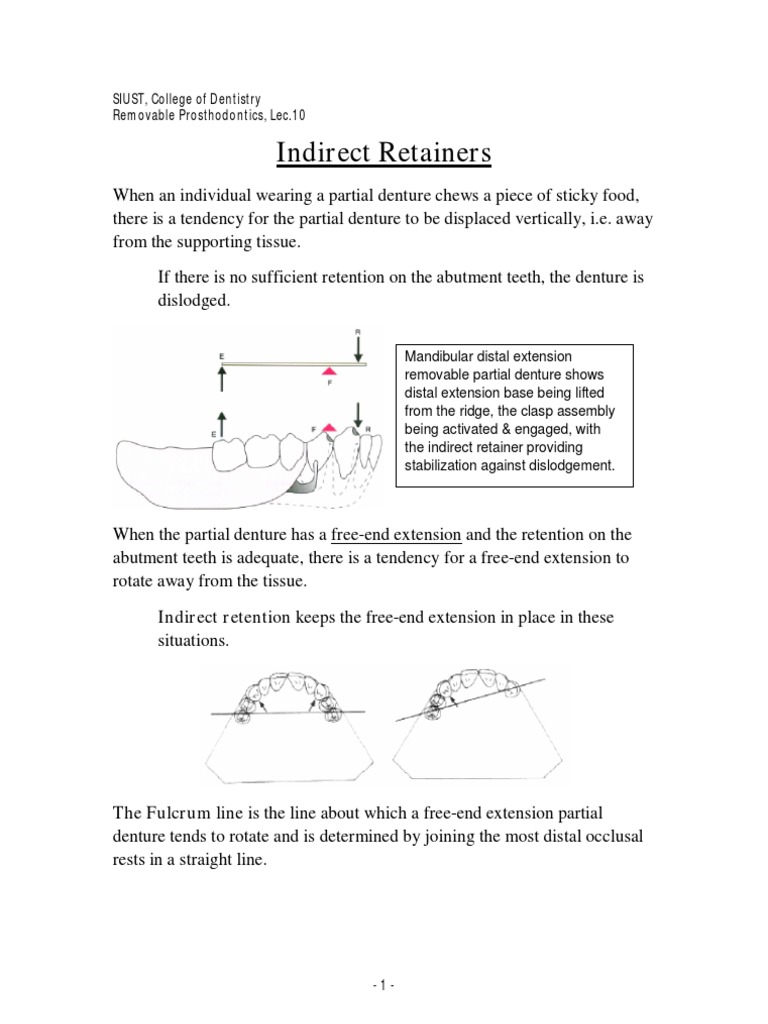 Removable Prosthodontics II - Lec.10, Indirect Retainers - Noor Al-Deen ...