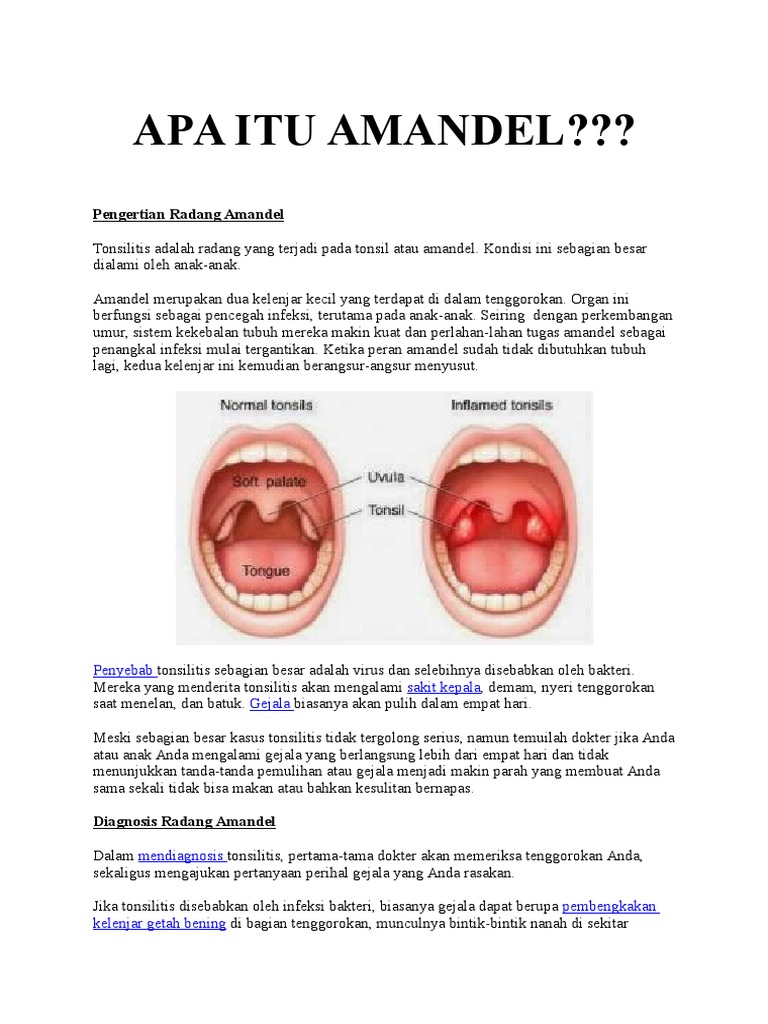 Apa Itu Amandel | PDF