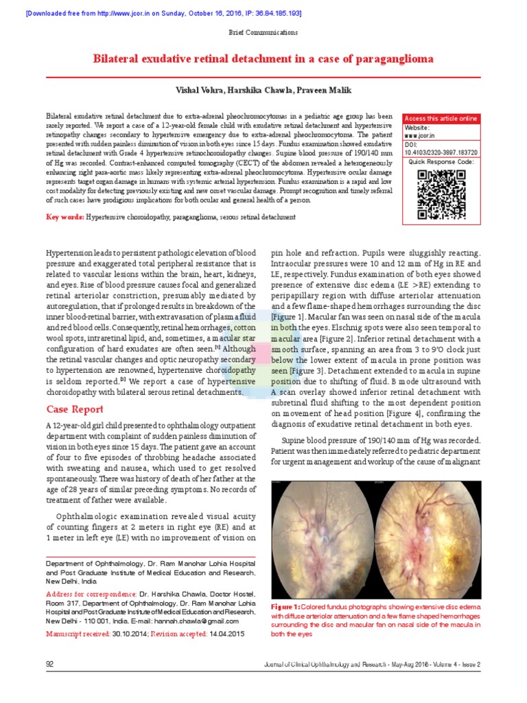 Bilateral Exudative Retinal Detachment in A Case of Paraganglioma | PDF ...
