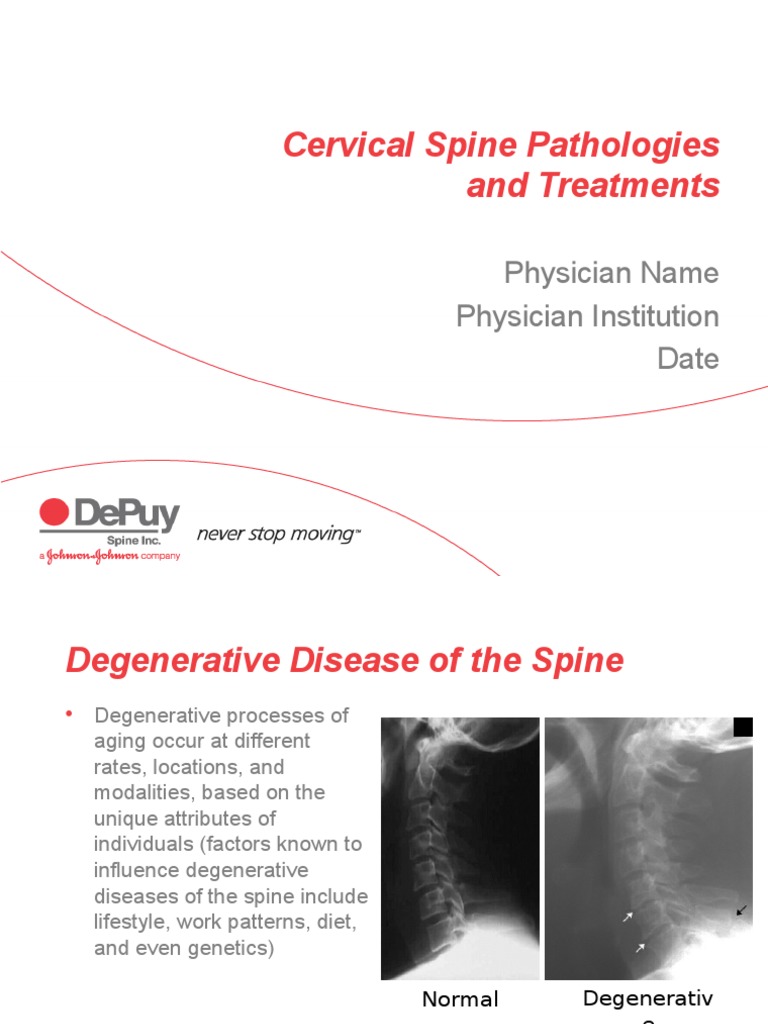 Cervical Pathologies Treatments | PDF | Vertebral Column | Vertebra