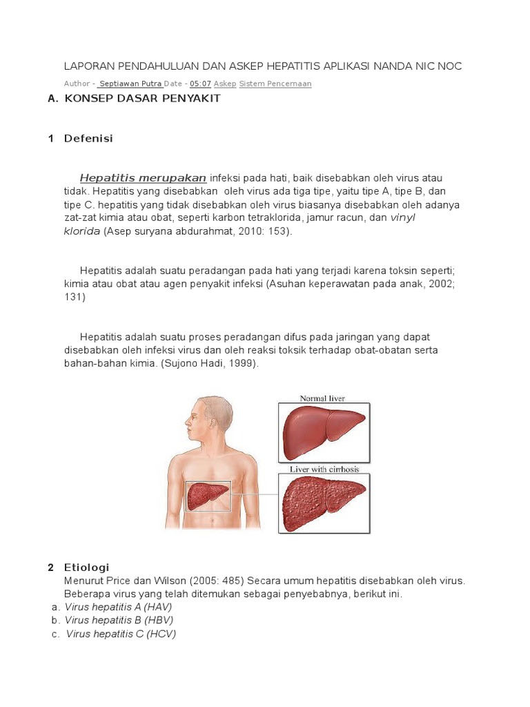 Laporan Pendahuluan Dan Askep Hepatitis Aplikasi Nanda Nic Noc | PDF
