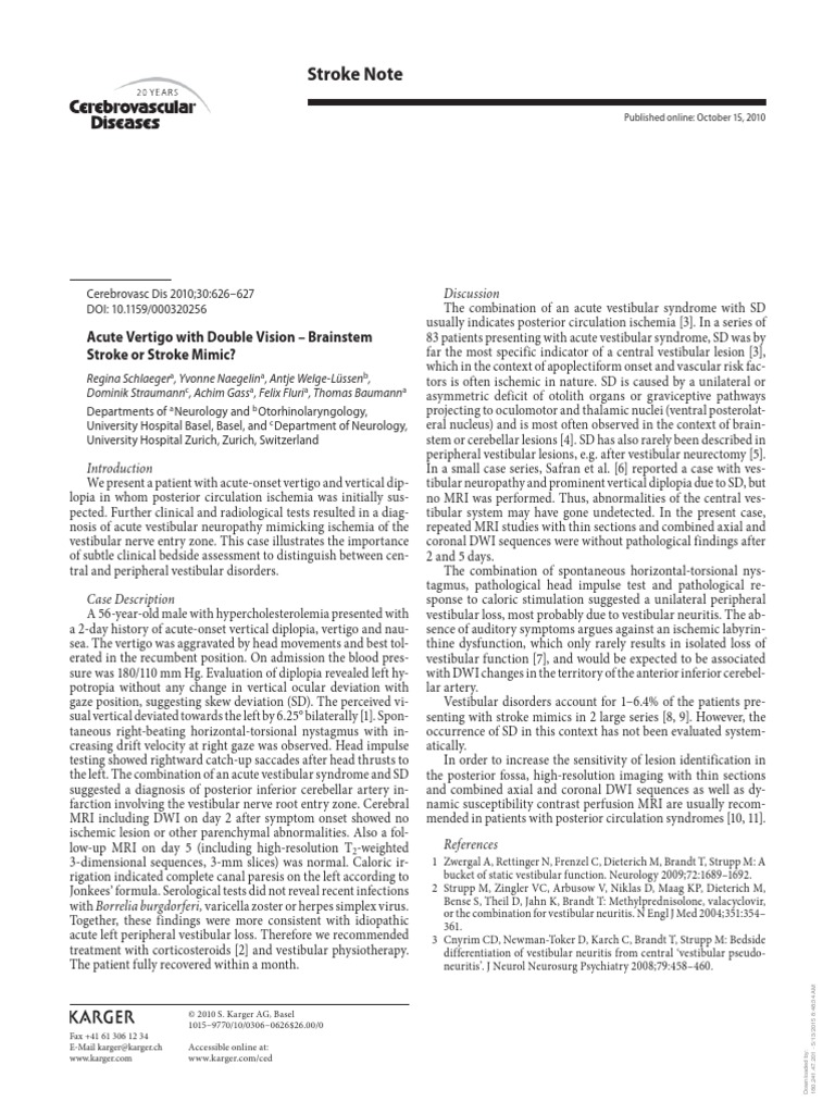 Stroke Note: Acute Vertigo With Double Vision - Brainstem Stroke or ...