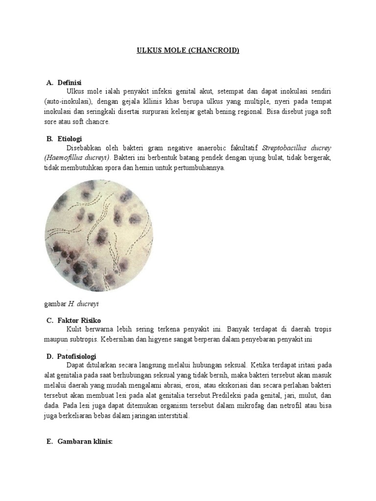 Ulkus Mole | PDF
