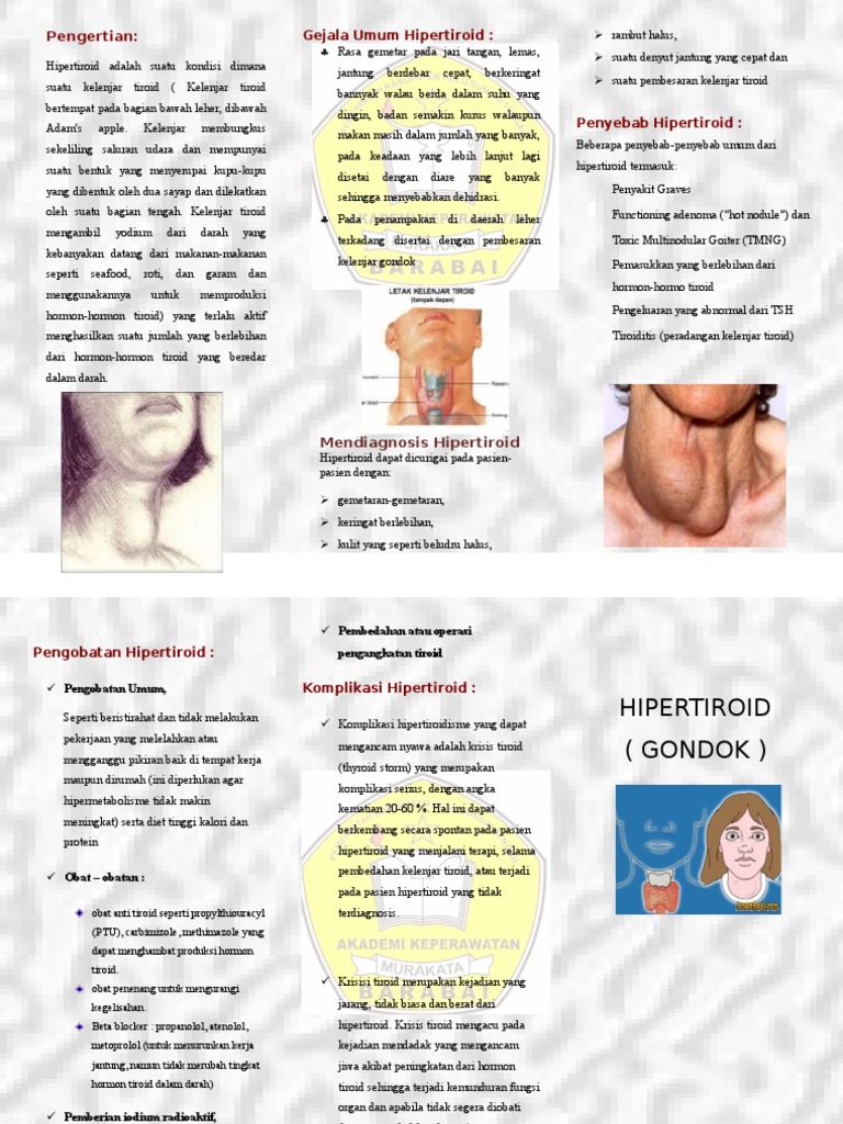 Leaflet Hipertiroid | PDF