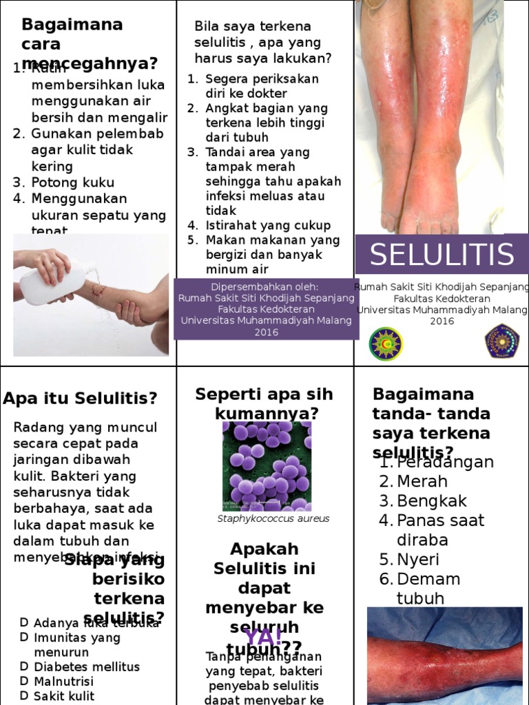 Leaflet Selulitis | PDF
