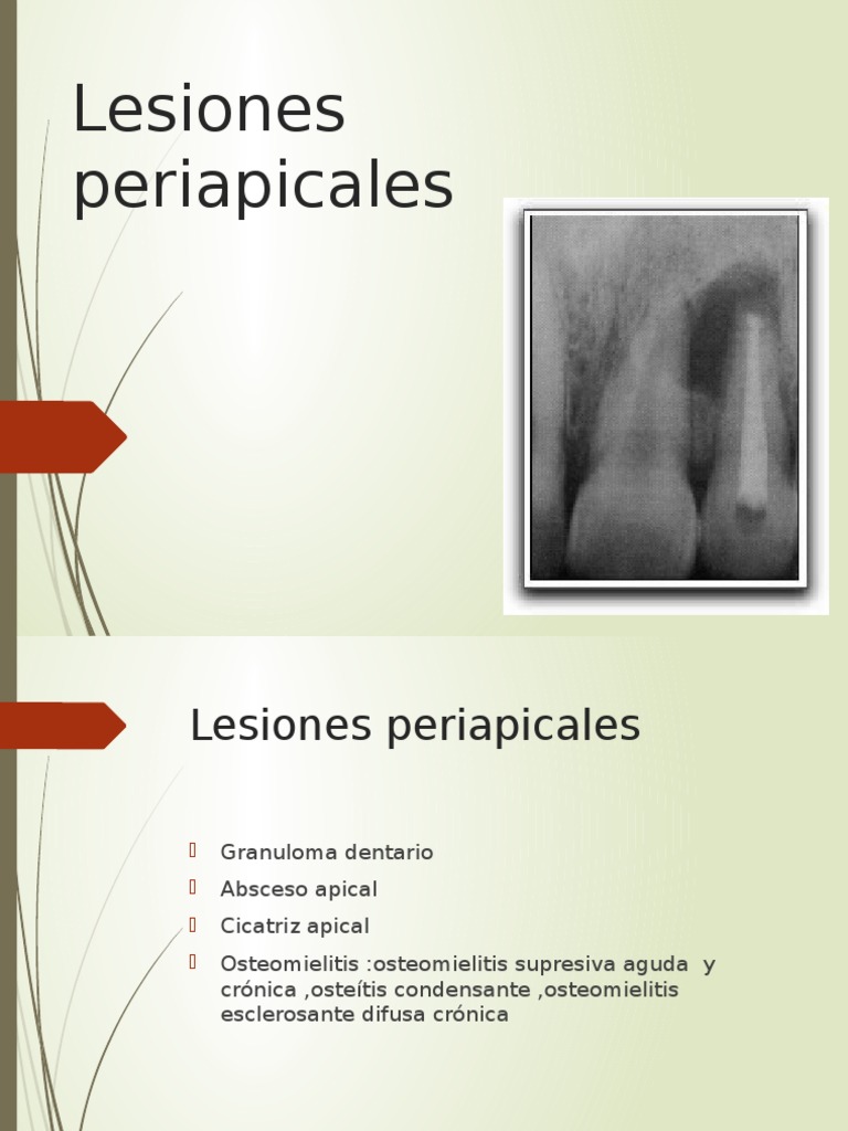 Lesiones Periapicales | PDF | Diente humano | Inflamación