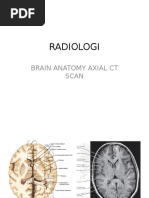 Brain MRI Protocols and Planning Guide | PDF | Magnetic Resonance ...