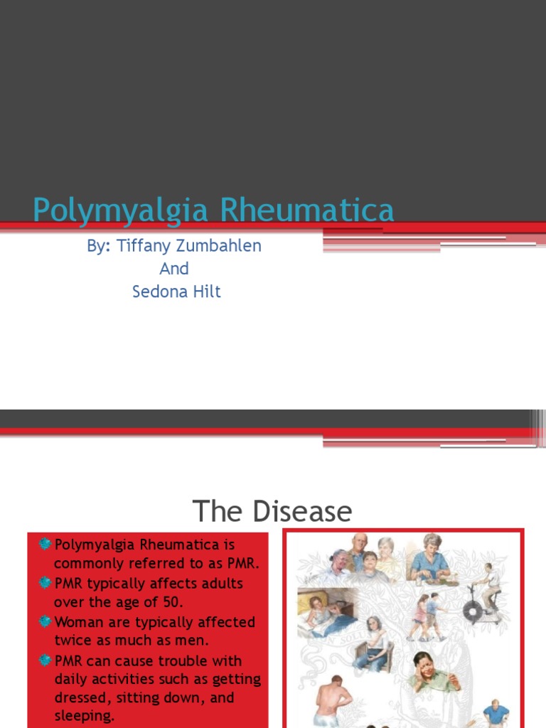 Understanding Polymyalgia Rheumatica | PDF | Wellness