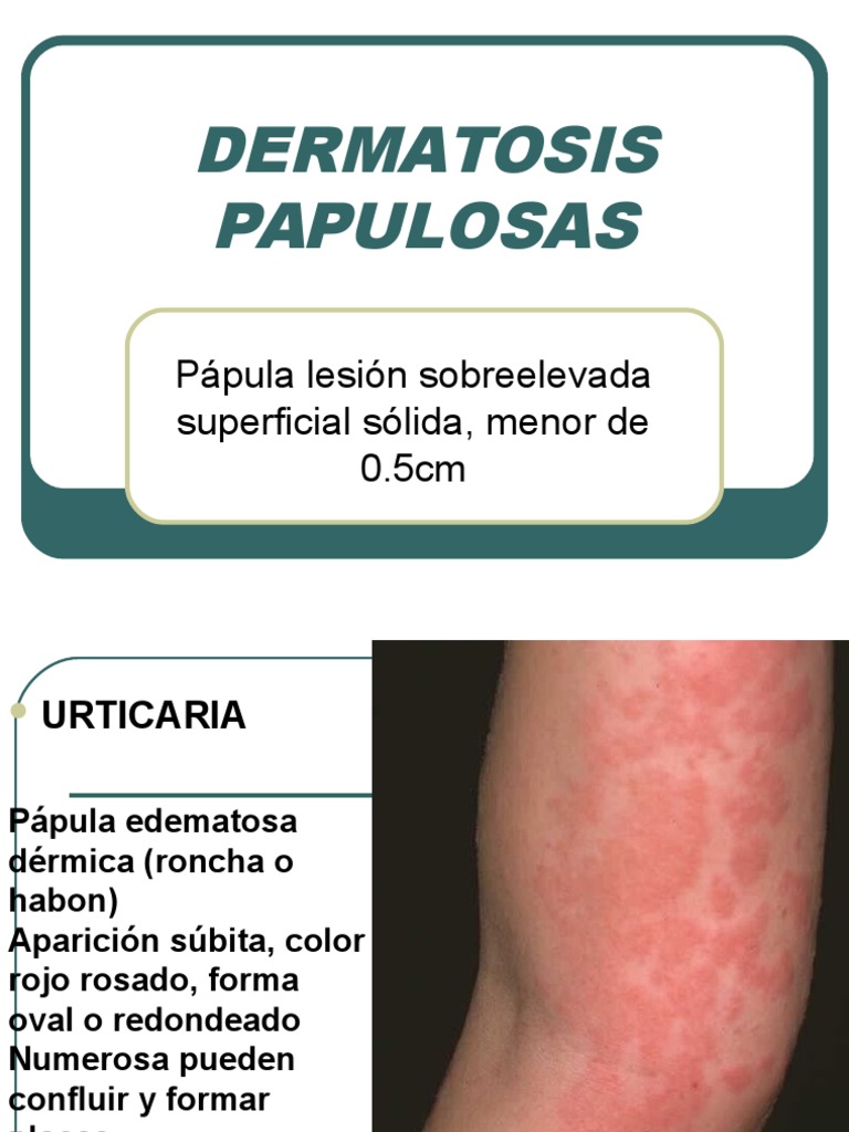 DERMATOSIS PAPULOSAS | Alergia | Condiciones cutáneas