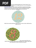 Ishihara Test Sheet | PDF | Image Processing | Ophthalmology