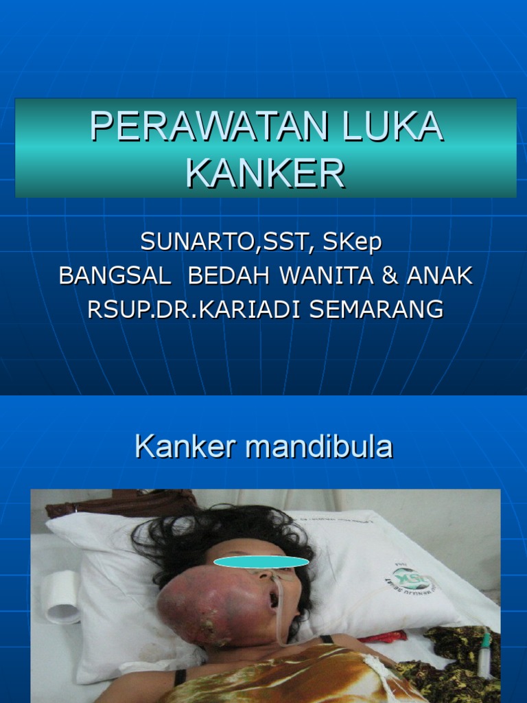 Perawatan Luka Kanker | PDF