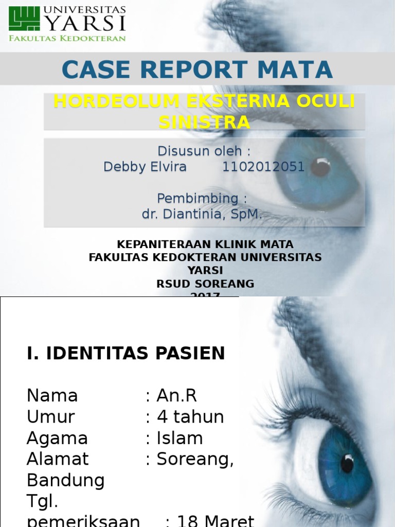 Case Report Hordeolum Eksterna | PDF