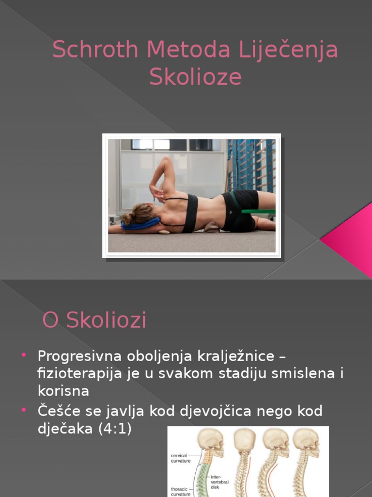 Schroth Metoda Liječenja Skolioze | PDF