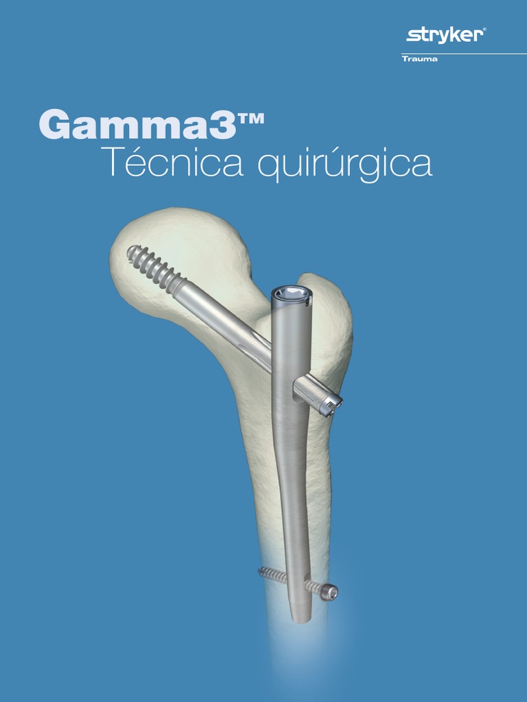 Gamma3 PDF | PDF | Tornillo | Cirugía