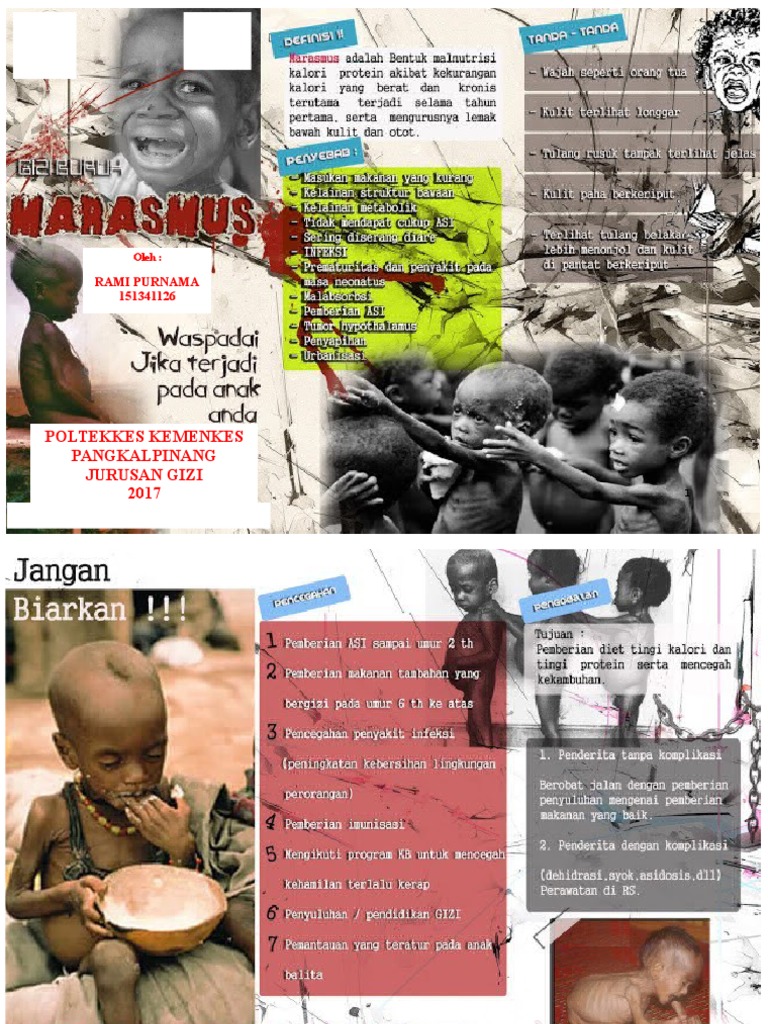 Leaflet Marasmus | PDF