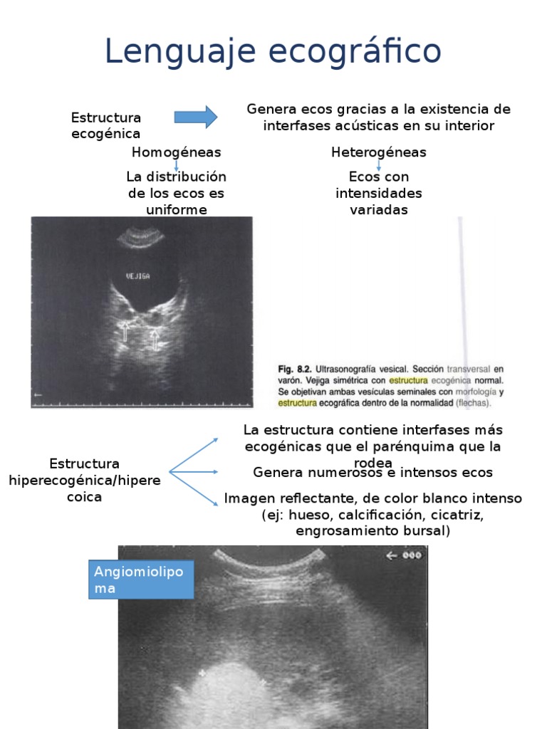 Guía de Estructuras Ecográficas y Ecogenicidad | PDF