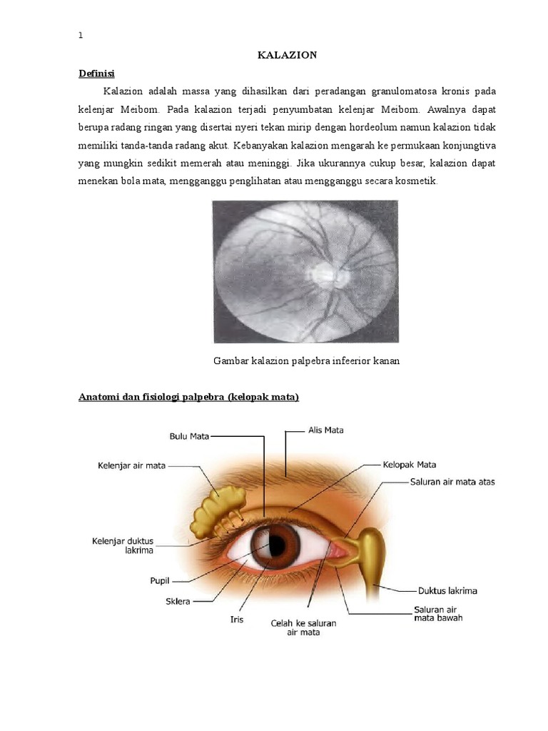 Tatalaksana dan Patofisiologi Kalazion | PDF | Sains & Matematika