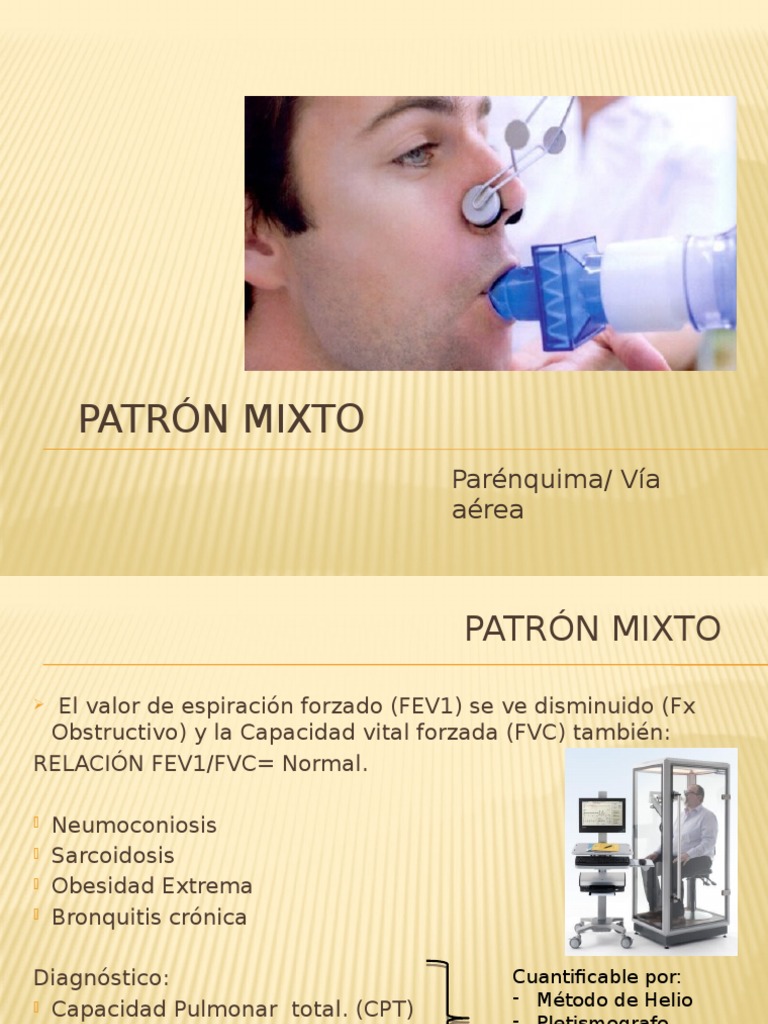 Patrón Mixto | PDF