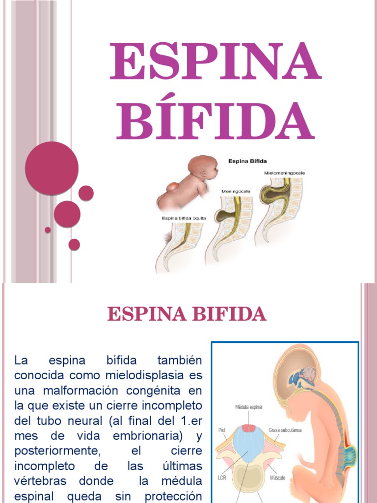 Espina Bifida | PDF | Enfermedades y trastornos | Medicina CLINICA