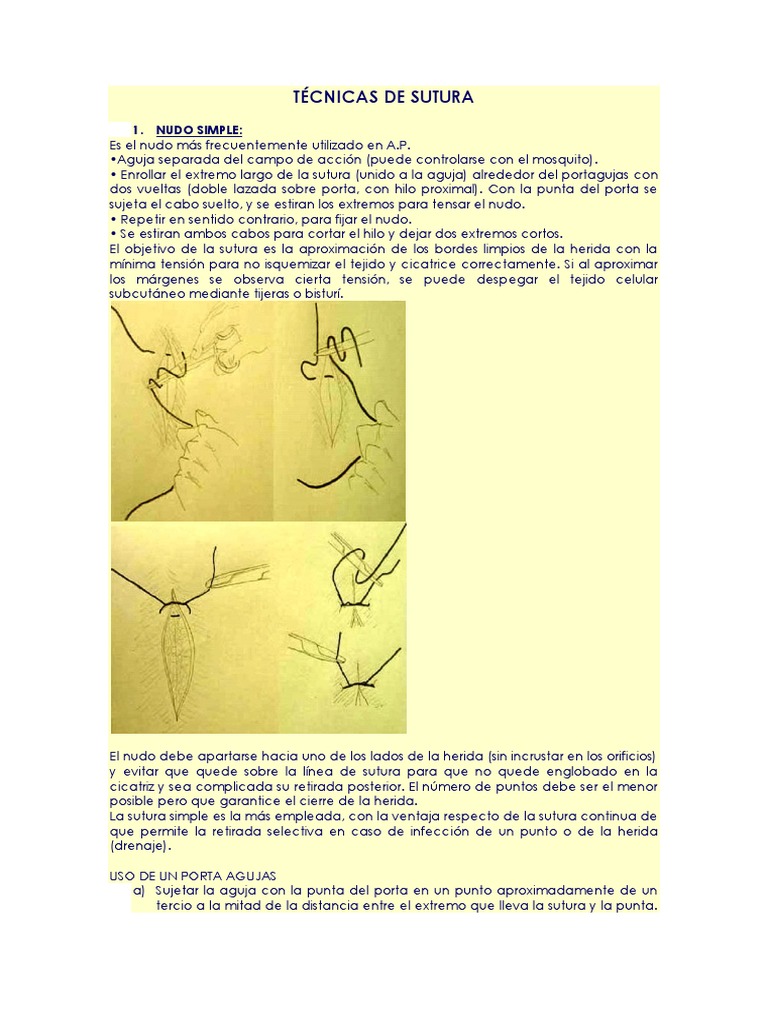 Técnicas De Sutura: 1. Nudo Simple