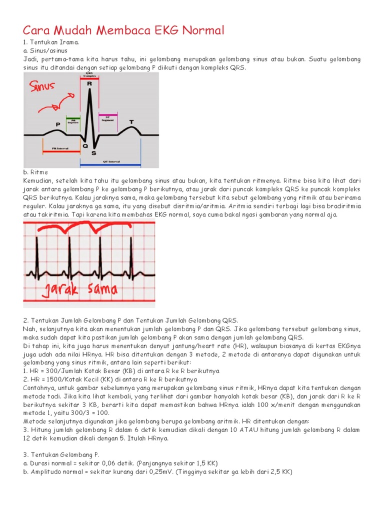 Cara Mudah Membaca EKG Normal | PDF