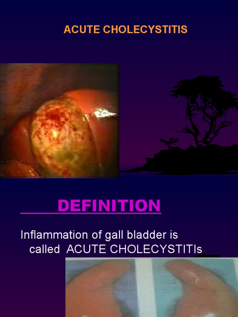 Acutecholecystitis 131207094939 Phpapp02h | PDF | Digestive System ...