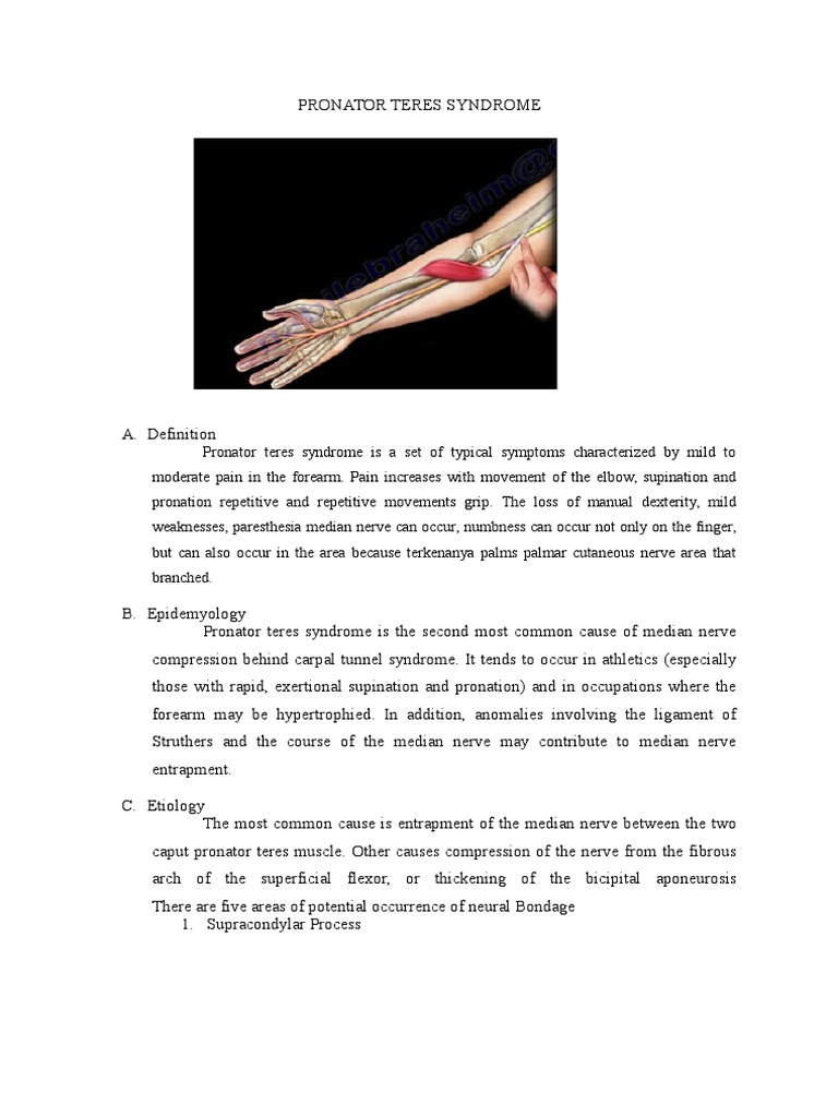 Pronator Teres Syndrome Treatment Exercises – GONKWS