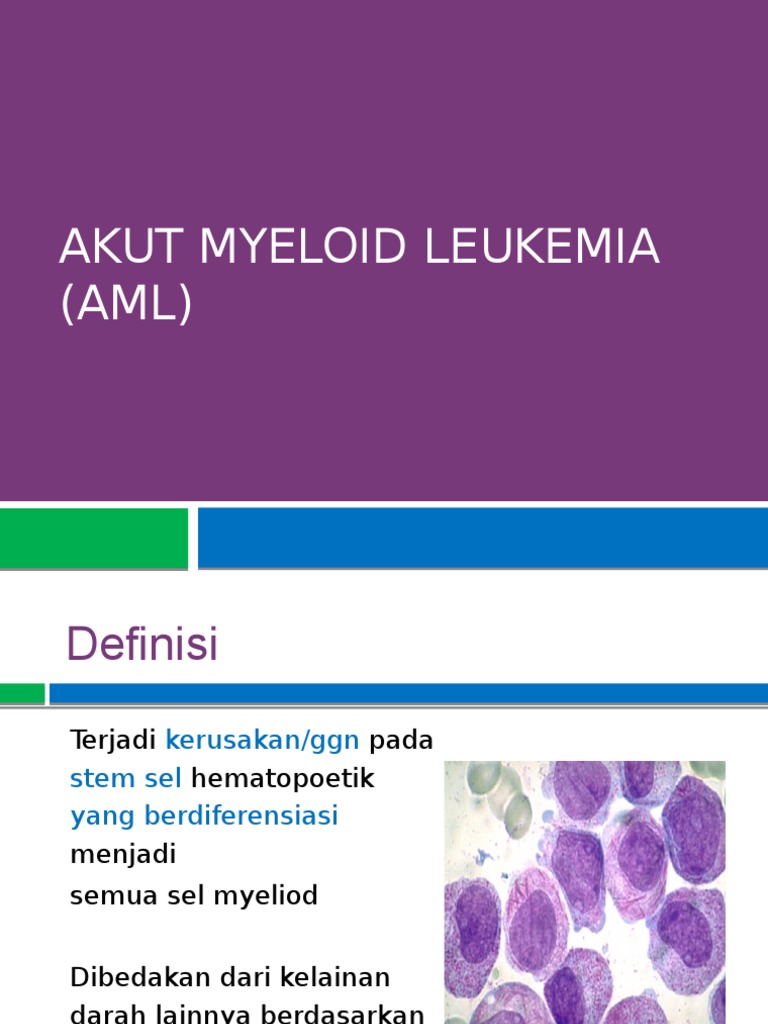 LO Akut Myeloid Leukemia (AML) | PDF
