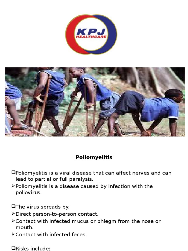 Post Polio Syndrome (PPS) | Poliomyelitis | Human Anatomy
