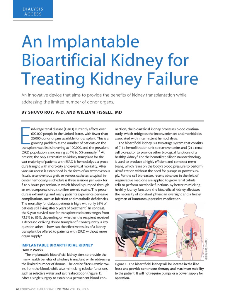 An Implantable Bioartificial Kidney For Treating Kidney Failure | PDF ...