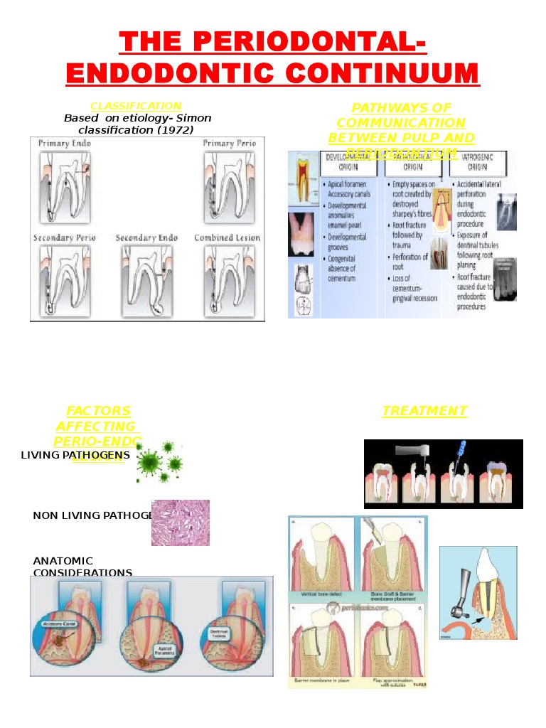 The Interrelationship Between Periodontal and Endodontic Disease: A Classification and Treatment ...