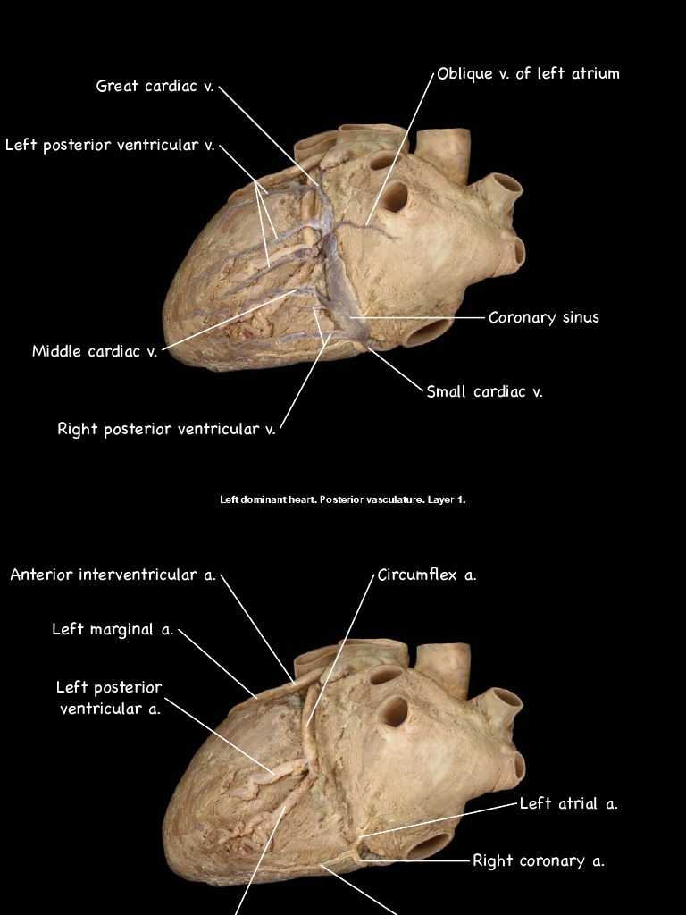Labeled Left-Dominant Heart Prosection