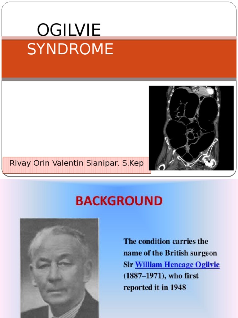 Persentasi OGILVIE SYNDROME Rivay | PDF