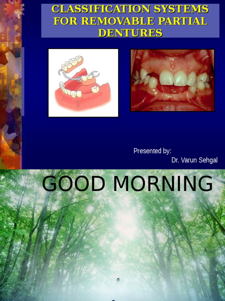 Classification Systems for Removable Partial Dentures: A Review of ...