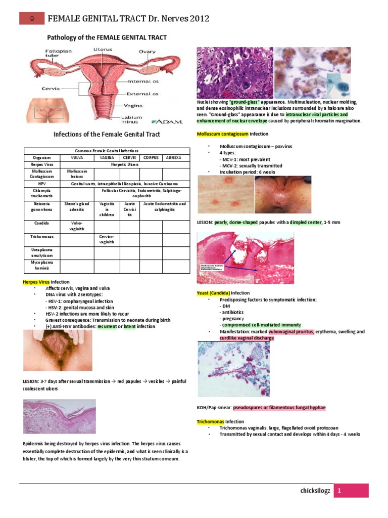 Female Pathology | Epithelium | Carcinoma