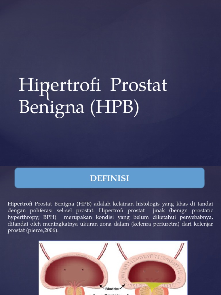 Hipertrofi Prostat Benigna (HPB) | PDF