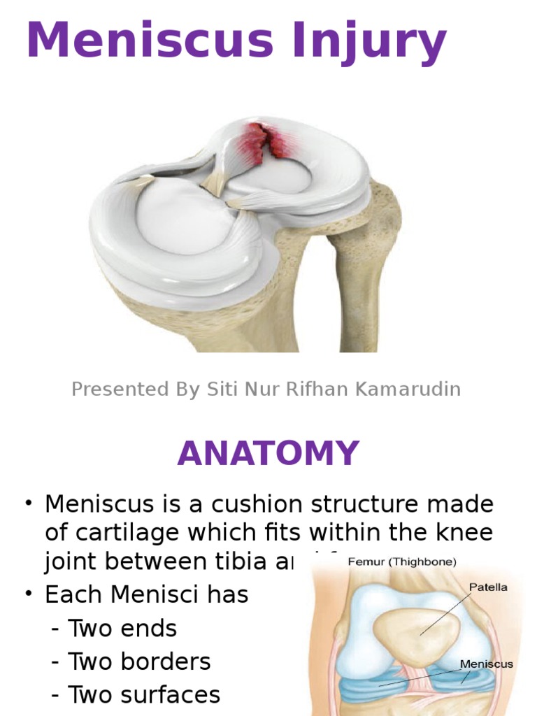 Meniscus Injury | Knee | Lower Limb Anatomy