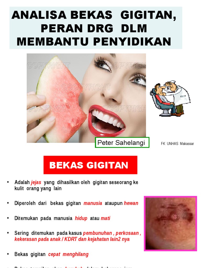 Bite Mark Evidence Final Ind | PDF