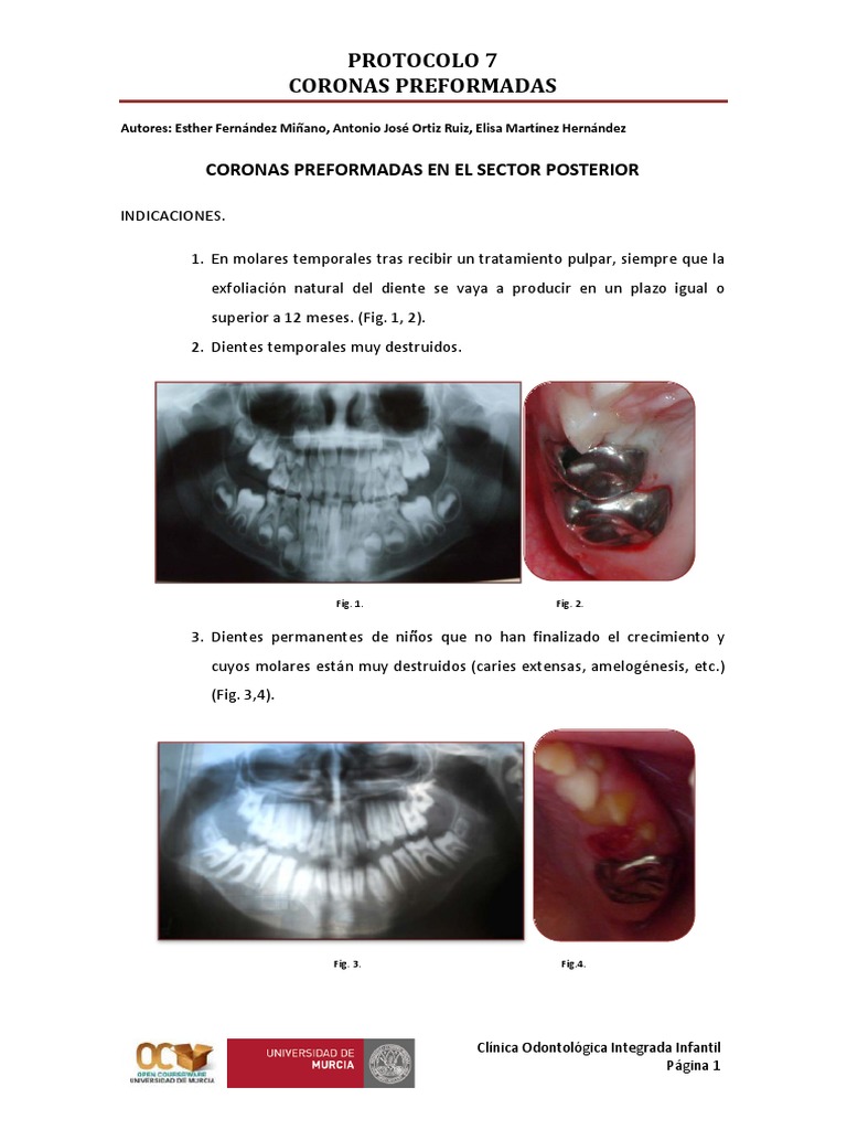 Protocolo 7 PDF | PDF