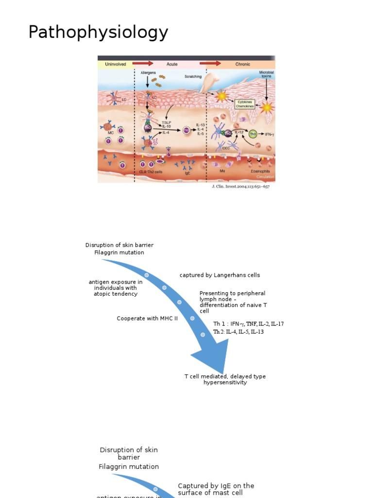 Atopic Dermatitis Pathophysiology Explained | PDF