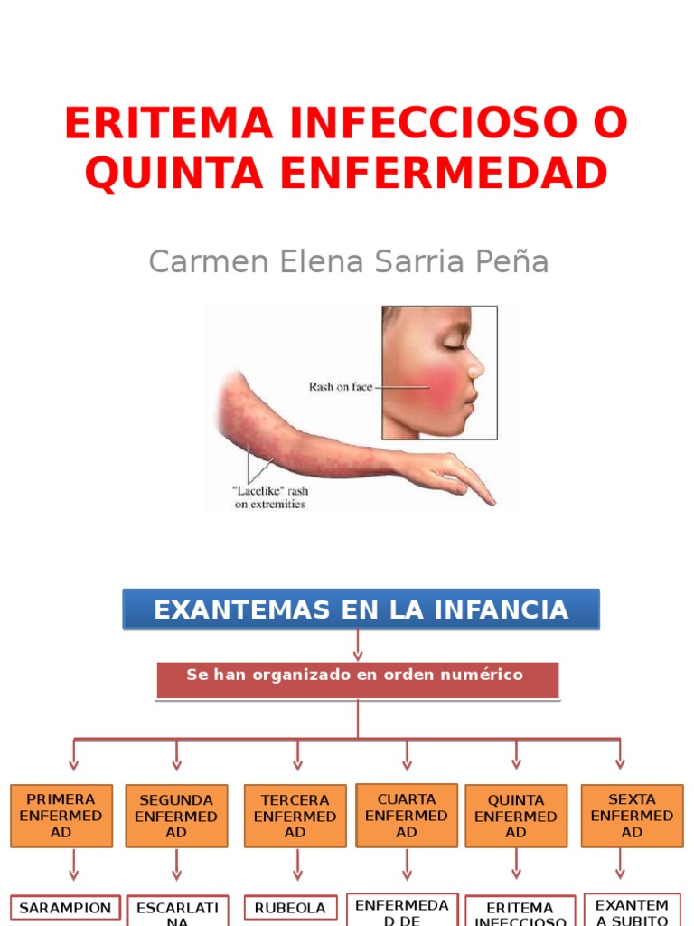Eritema Infeccioso o Quinta Enfermedad | PDF | Virus | Infección