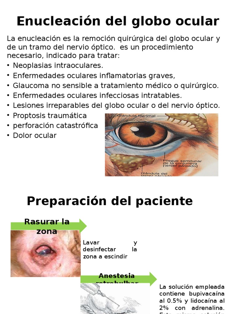 enucleacion | Cirugía | Ojo