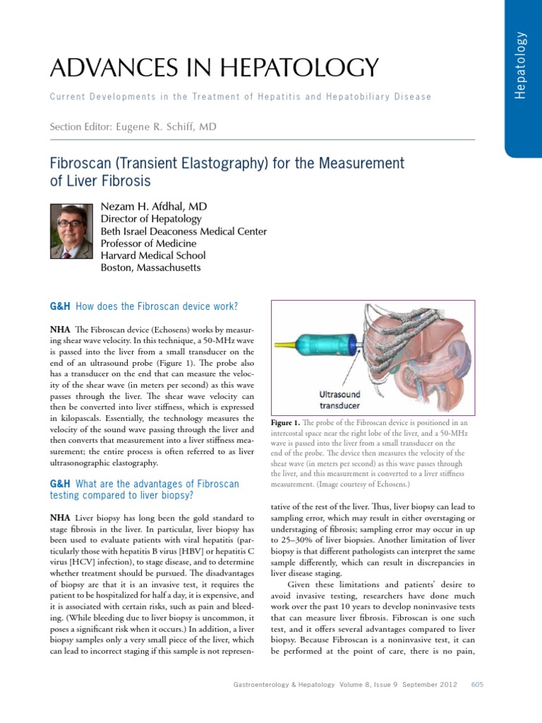 Fibroscan | Cirrhosis | Hepatitis