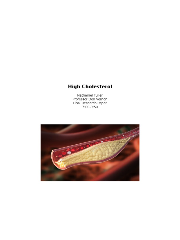 Understanding High Cholesterol Risks | PDF | Cholesterol | Lipoprotein